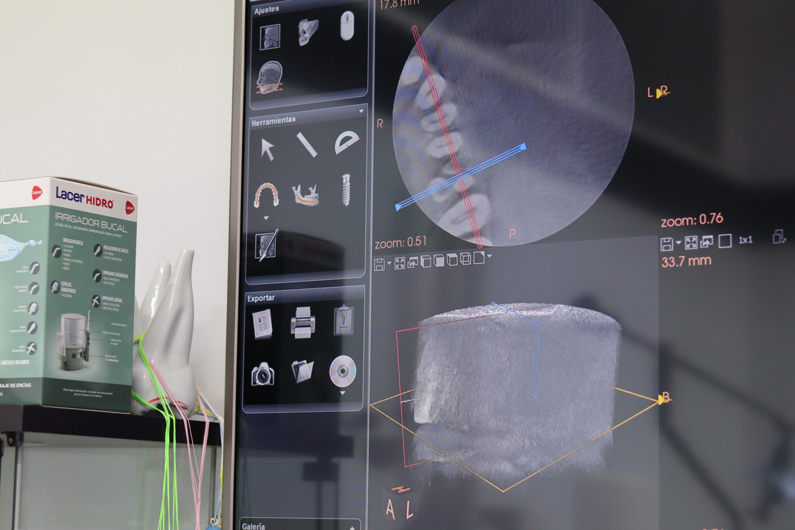 Tratamientos Dentales » Saiz & Tauler